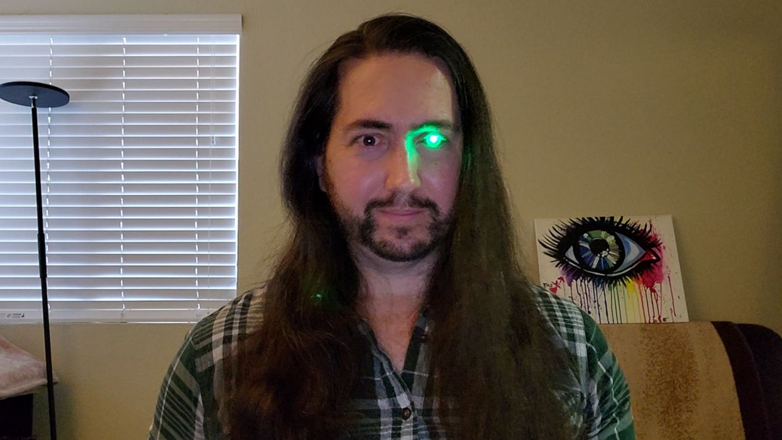 Man Loses Eye To Cancer Turns Prosthetic Eye Into Flashlight Good Morning America