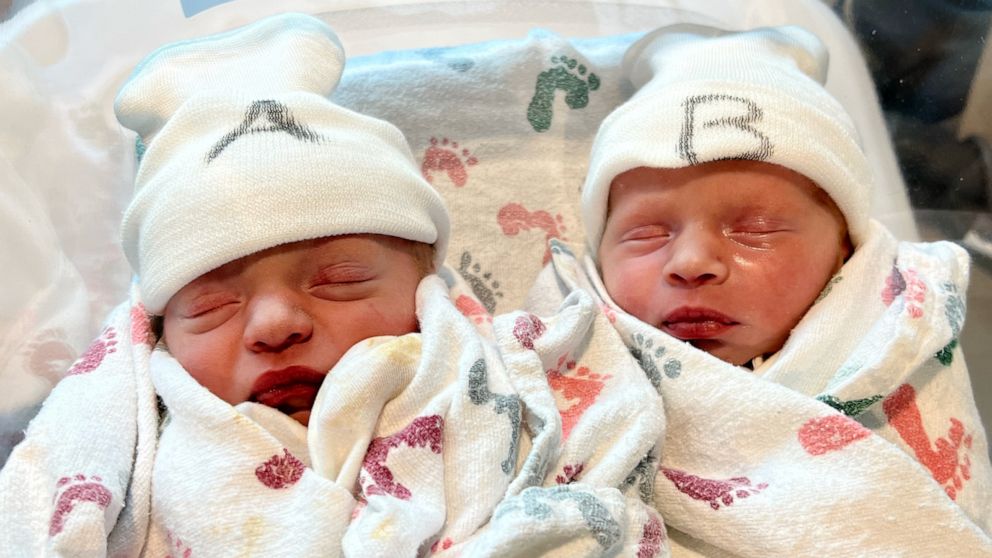 These fraternal twin sisters were born on different days in different ...