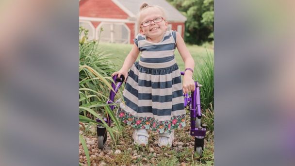 9-year-old born with rare form of dwarfism uplifts others with her ...