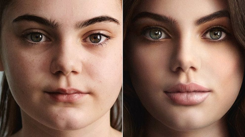 Doves Reverse Selfie Video Tackles Digital Distortion On Social Media Abc News
