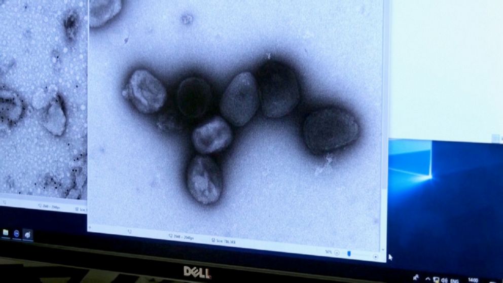 2 people dead in Chicago after monkeypox diagnosis | GMA