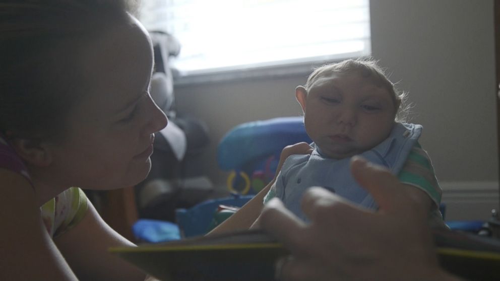 Florida 'Miracle Baby' Born Without Most of His Brain Beating the Odds ...