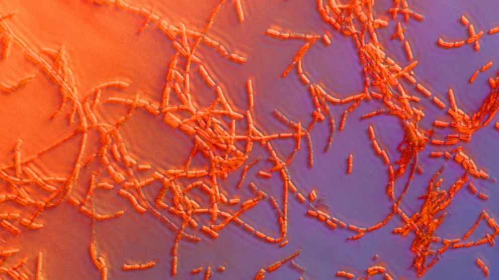75 Potentially Exposed to Anthrax in CDC Breach - ABC News