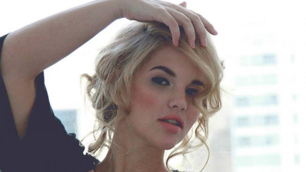 Plus Model Elly Mayday Continues to Pose Despite Bald Head, Scars - ABC ... Plus Model Elly Mayday Continues to Pose Despite Bald Head, Scars - ABC ...