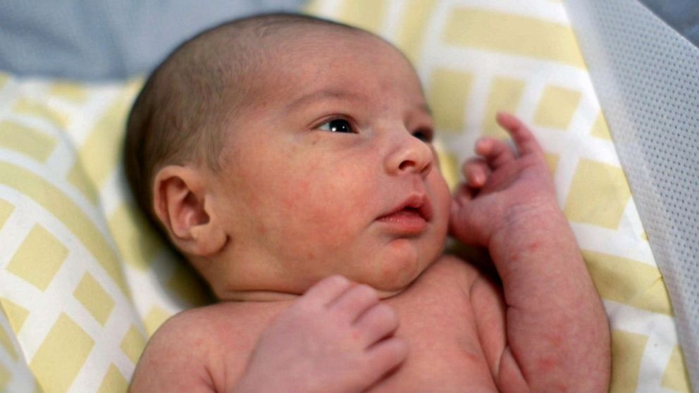 How IVF has redefined the modern family - ABC News