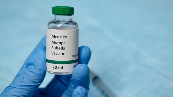 7th measles case confirmed in outbreak linked to elementary school in ...