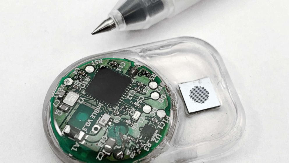 A smart drug implant – controlled from a smartphone – could treat ...