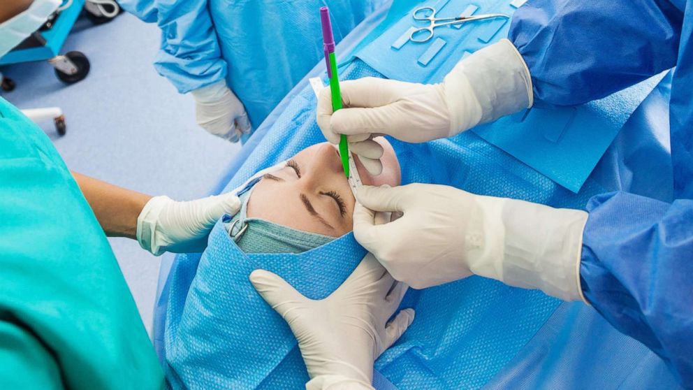 As teens turn to cosmetic surgery, study outlines new age-appropriate ...
