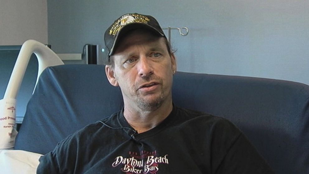 Man Loses Leg To Flesh Eating Bacteria After Wading In The Gulf Of