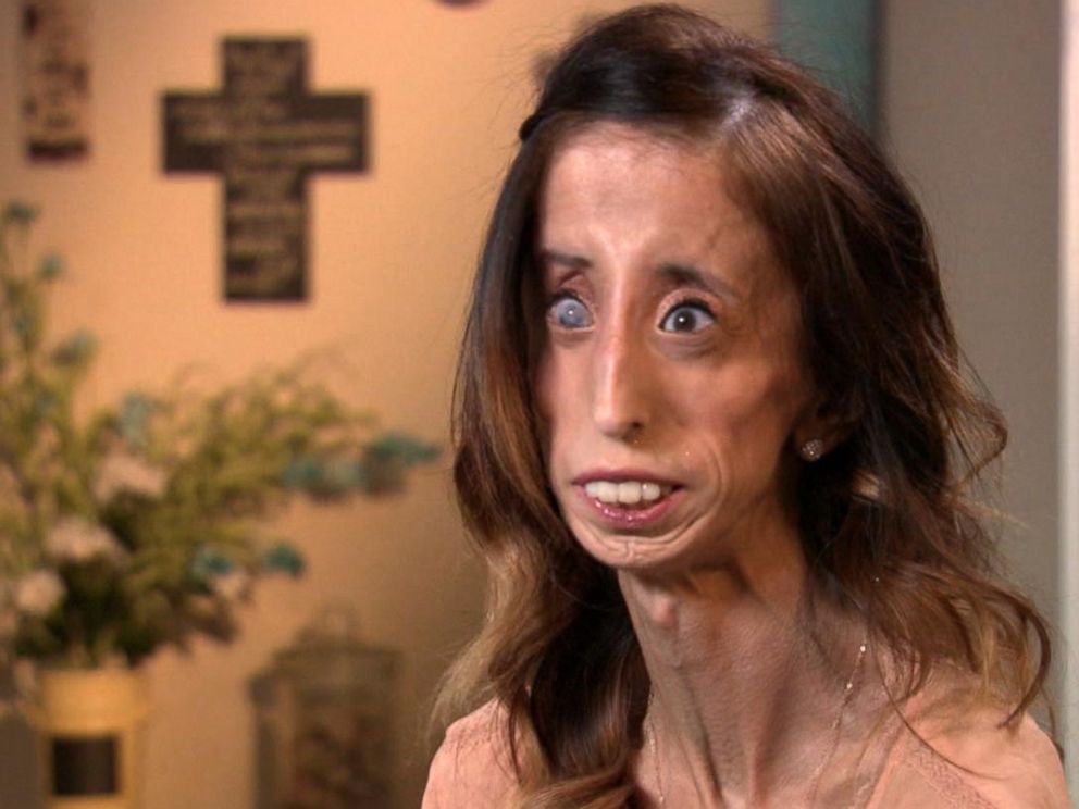 Lizzie Velasquez Parents