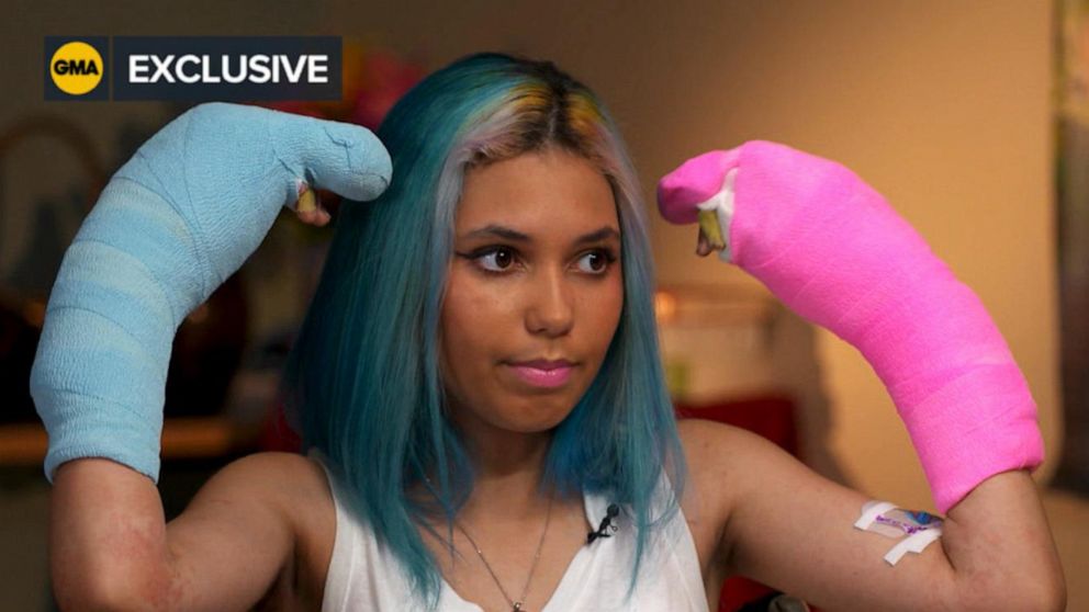 Doctor who treated shark attack survivor on her life-saving surgery | GMA