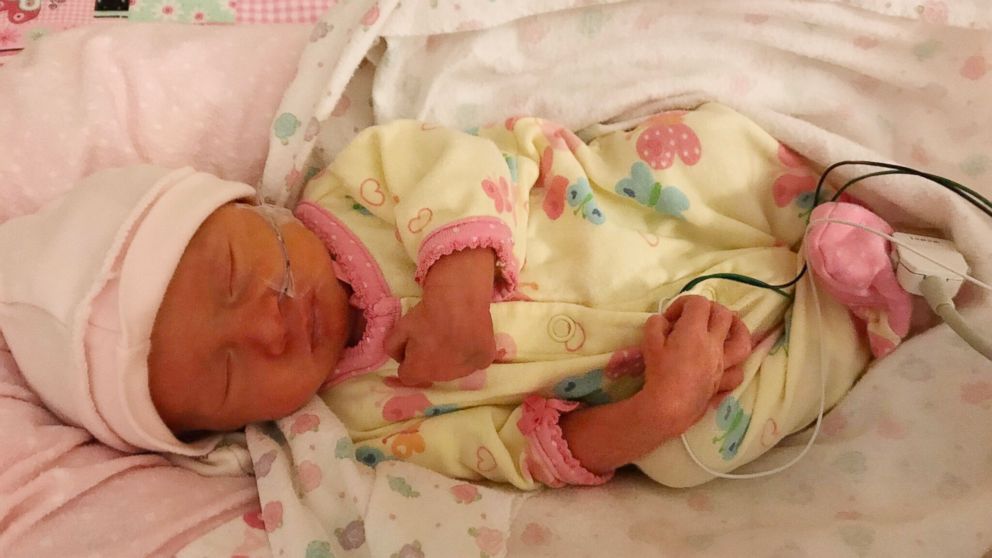 Mom credits app with saving baby's life - ABC News