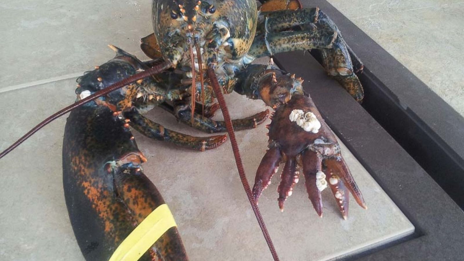 What Causes Lobster Hands