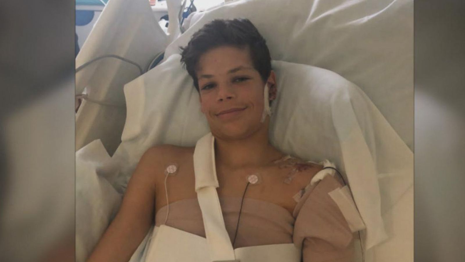Mom of teen attacked by shark speaks out - Good Morning America