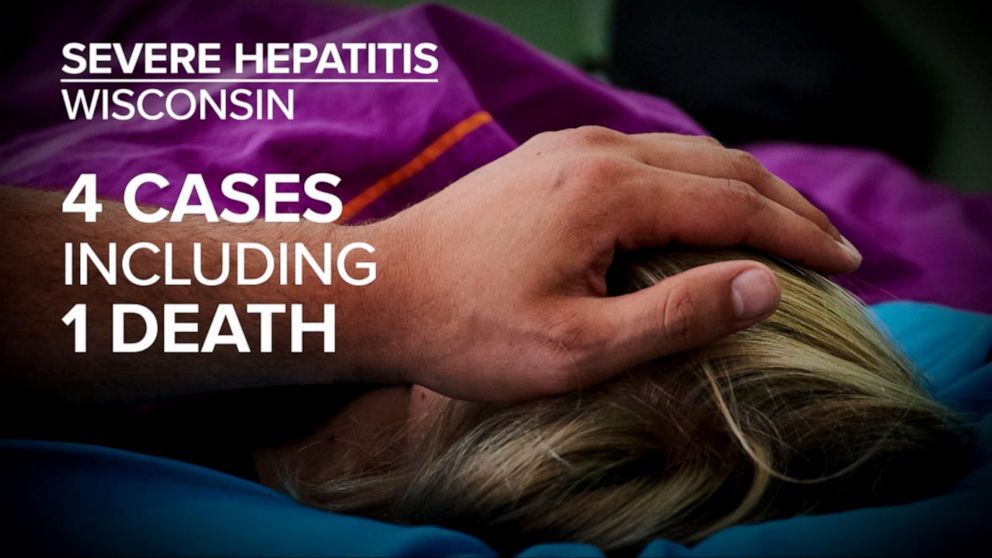 Concerns grow over hepatitis outbreak | GMA