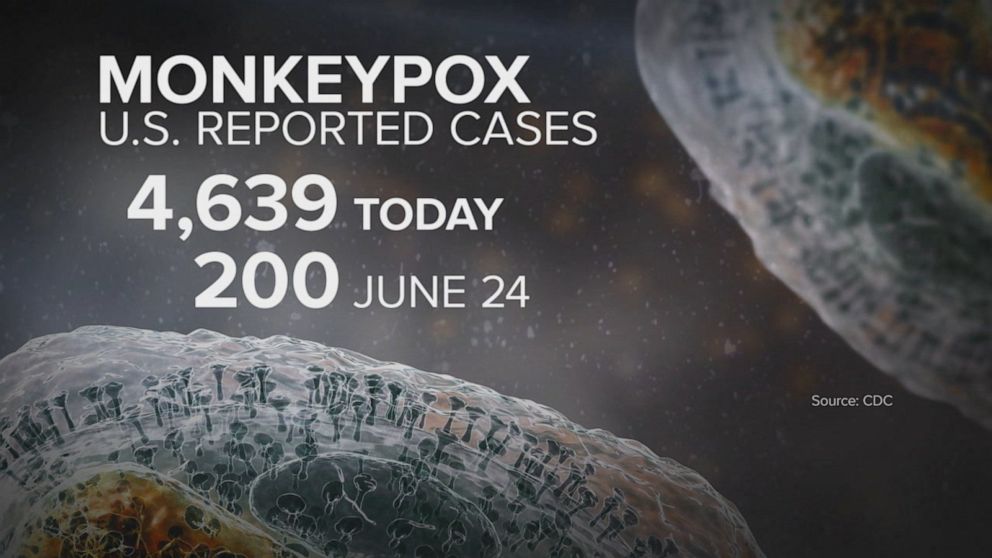 CDC reports a jump in monkeypox cases in the US | GMA